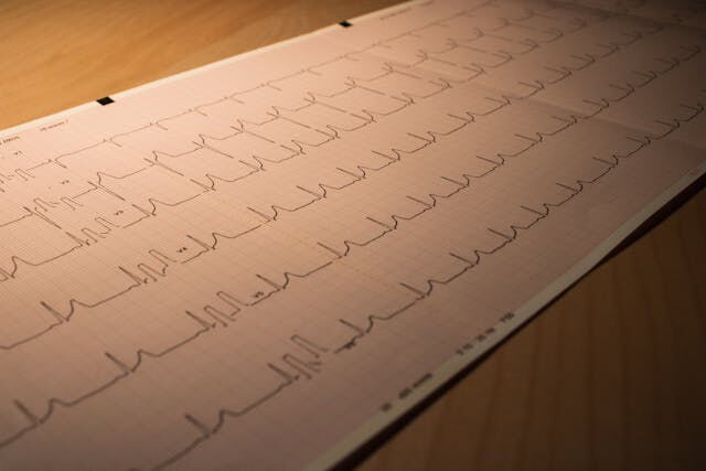 Medicalgorithmics Ce Certified For Ai Ecg Data Analysis 5098